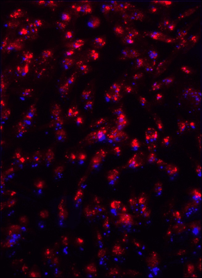 Research Focus | Iverson Lab | Nebraska
